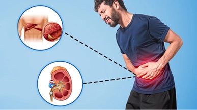 Understanding Gallbladder and Kidney Stones: Causes, Symptoms, and Tre
